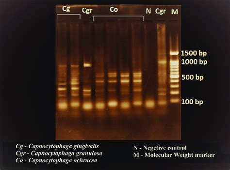 Polymerase Chain Reaction Restriction Fragment Length Polymorphism