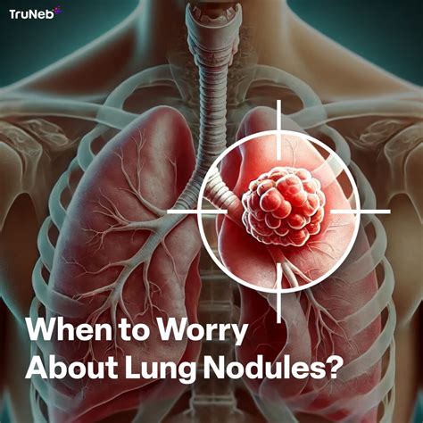 When To Worry About Lung Nodules A Comprehensive Guide