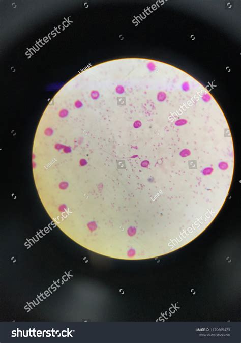 Leishmania Under Microscope Leishmania Under Microscope