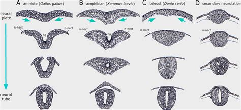 Secondary Neurulation