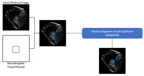 Get Started With Medical Segment Anything Model For Medical Image Segmentation Matlab And Simulink