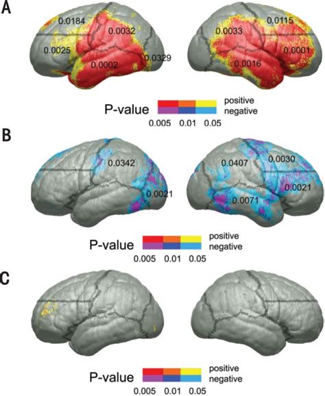 A Uncorrected P Maps Representing The Significance Of Group Download Scientific Diagram