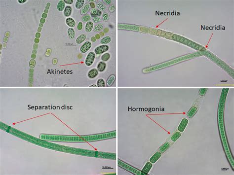 Chapter 13 The Hidden World Of Cyanobacterial Cell Death Classification Regulatory