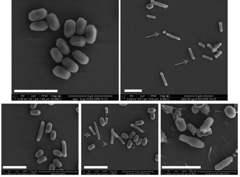 Bacillus Atrophaeus Spores Visualized Via Sem A Spores Suspended In