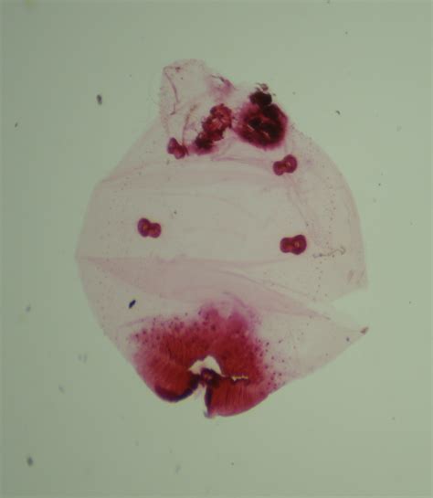 Trichomonas Vaginalis Slide