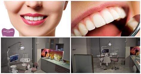 Почистване на зъбен камък с ултразвук и полиране с Airflow плюс дентален преглед разграбена