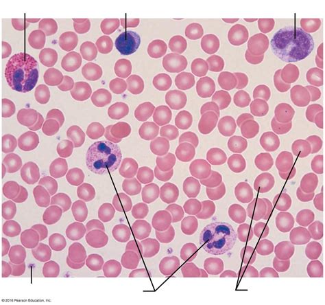 Labeled Blood Smear Slide At Ronald Lockett Blog