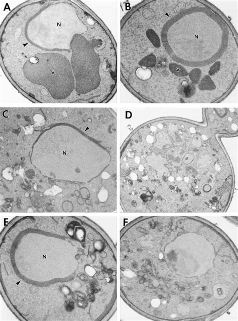 Vps16 101 And Vps16 102 Have Abnormal Vacuole And Karmellae Download Scientific Diagram