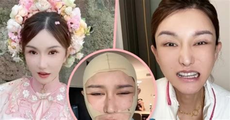 평생 찡그린 얼굴로 살아야 하는 트랜스젠더원인은 성형중독