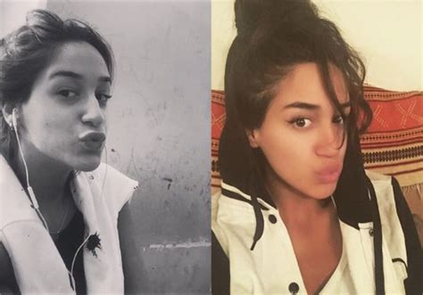 ეკა კახიანის უმცროსმა ქალიშვილმა ცხვირის ოპერაცია გაიკეთა ფოტოები