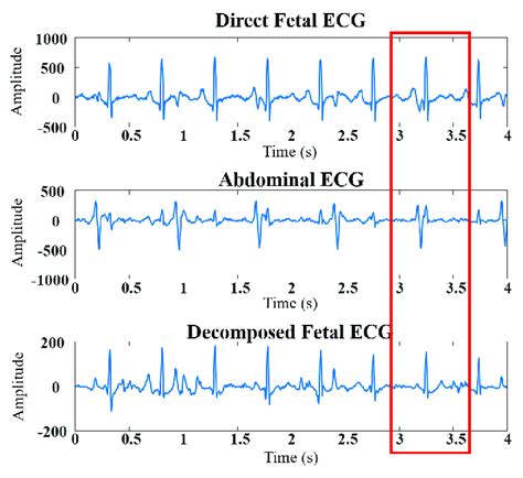 Examples Of Sections Showing The Overlap Between Maternal And Fetal Download Scientific Diagram
