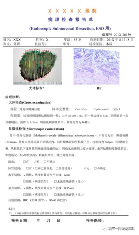 早期胃癌及其前驱病变esd标本取材及诊断规范医学界 助力医生临床决策和职业成长