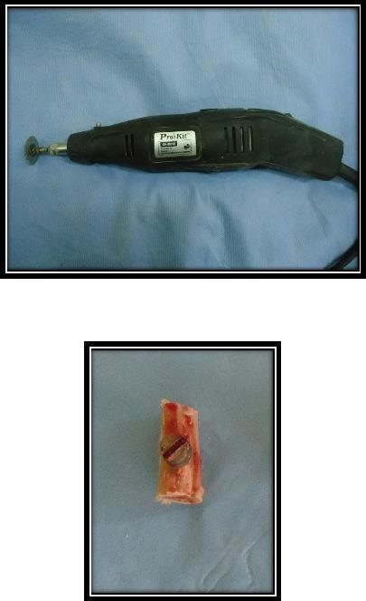 21 Bone Implant Block Download Scientific Diagram
