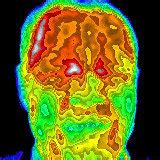 Visible And Infrared Imagery Of An Infant Download Scientific Diagram