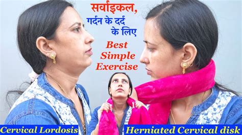 Cervical Exercise गर्दन का दर्द ख़त्म Cervical Disk Herniation Cervical Disc Cervical