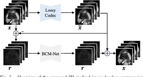 figure 3 from bilateral context modeling for residual coding in lossless 3d medical image