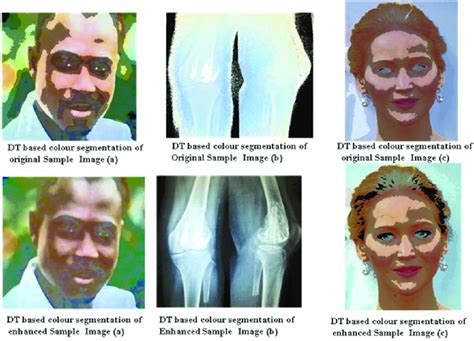 Dt Based Segmentation Of Images A B C For Each Original And Enhanced Download Scientific