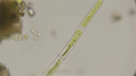 Algae Under Microscope