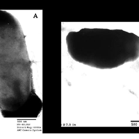 Transmission Electron Microscopy Of Cronobacter Sakazakii A Download Scientific Diagram