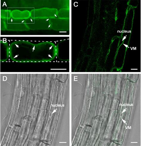 Subcellular Localization Of Pvacr3 1 In Plants Through The Observation Download Scientific