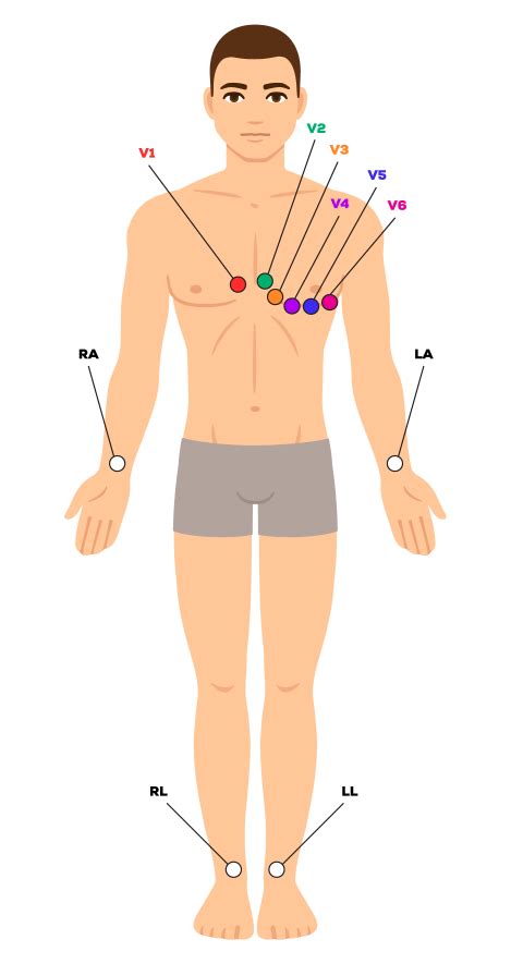 Proper Electrocardiogram Ecgekg Lead Placement Ecgedu 55 Off