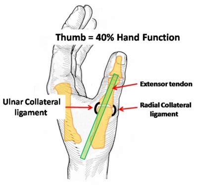 Radial Collateral Ligament Of The Thumb Wikism Sports Medicine Wiki