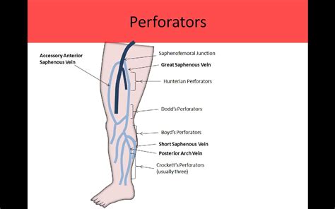 Soleus Vein Ultrasound At Ellen Franklin Blog