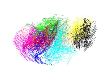 14 Some Visual Examples Of Kernel Pca Fiber Segmentation Download Scientific Diagram