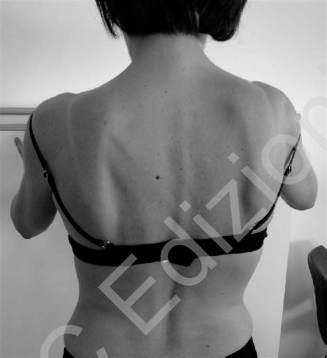 Patients Position To Evaluate Scapular Dyskinesis Download Scientific Diagram