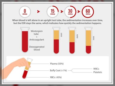 Esr Test Testing Levels And More Engiomed