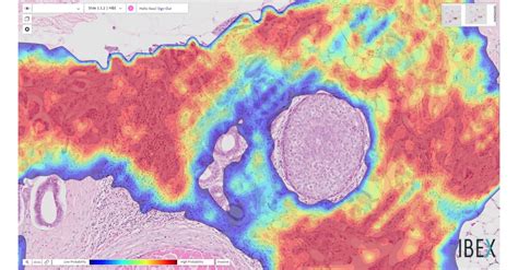 Dedalus And Ibex Powering Digital Pathology With Ai