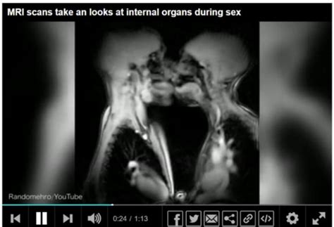 Figur 78 Med MRI Skanning Kan Man Studera Hur Olika Organ Arbetar Vid Download Scientific