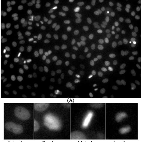An Example Of Blob Structure Hela Cell Nuclei Detection The Red Download Scientific Diagram