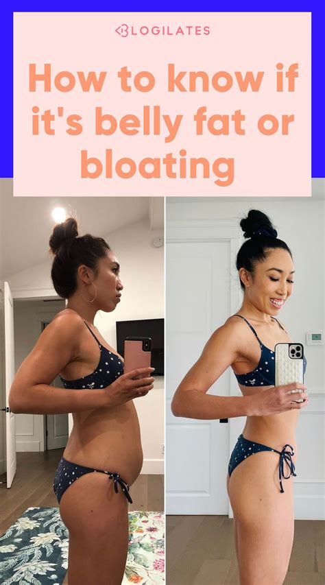 Why This Woman S Bloating Pictures Went Viral Artofit