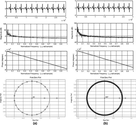Fft And Dft Analysis Of A Normal Ecg A And A Noisy Ecg B 17