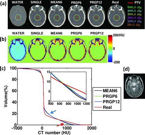 MRI Based Treatment Planning With Pseudo CT Generated Through Atlas Registration Abstract