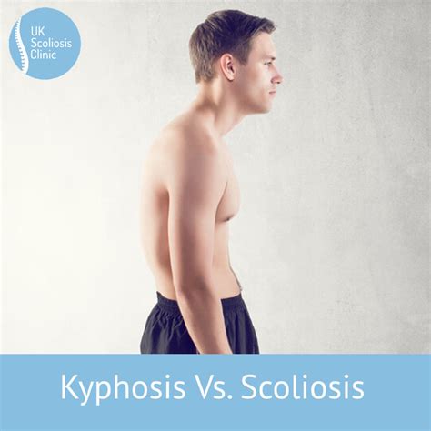 Lordosis Kyphosis Scoliosis