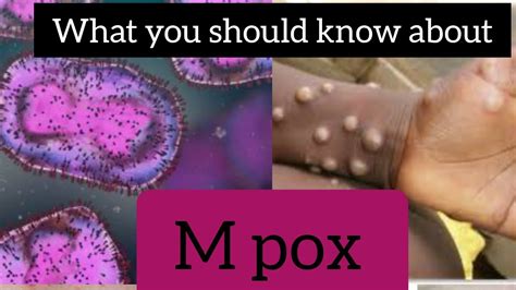 The Deadly M Pox Virus Keep Safe Youtube