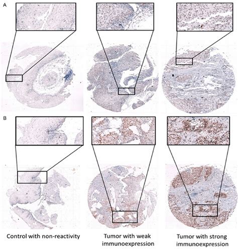 Tissue Microarray Based Immunohistochemistry For Kat8 And Prmt1 Tissue Download Scientific