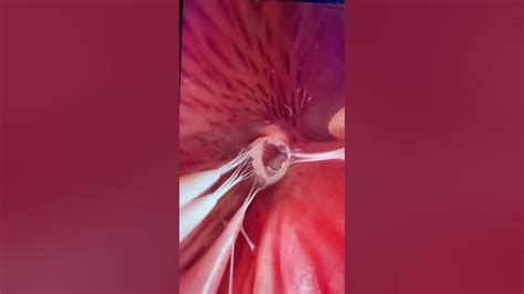 3d Animation Of The Tricuspid Valve Meded Anatomy 3dmodel Youtube