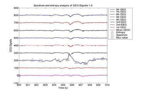 Entropy Analysis Of Eeg Signals 20 Download Scientific Diagram