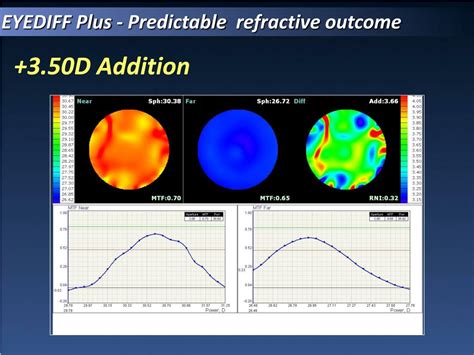 Ppt Eyediff Plus 3 50d Diffractive Multifocal Iol “a New Alternative” Powerpoint Presentation