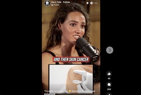 Unprotected Sun Overexposure Not Sunscreen Or Sunglasses Causes Sunburn And Skin Cancer