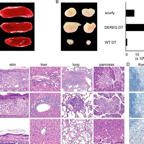 Depletion Of Foxp3⁺ Cells In Neonate Dereg Mice Results In A