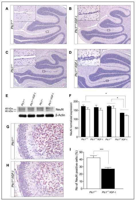 Delayed Differentiation In Neural Precursors Caused By Igf I Altered