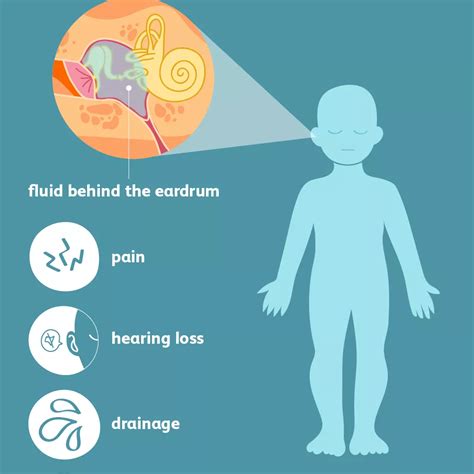 Gratitudebeliever Overview Of A Middle Ear Infection