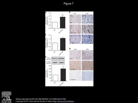 Parathyroid Hormonerelated Protein Protects Renal Tubuloepithelial