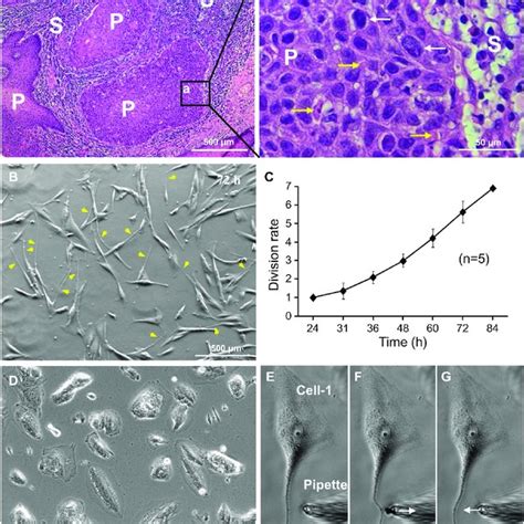 Characterization Of Lscc Cells A And A Moderately Differentiated