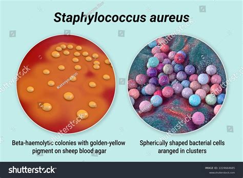 Bacteria Staphylococcus Aureus Colonies On Sheep Stock Illustration 2224664685 Shutterstock