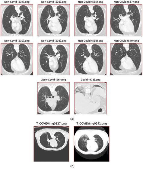 Ct Scan Images That Required Minor Cropping A Images From The